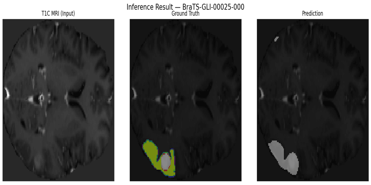 GitHub - SAYYED-09/BrainTome: BrainTome: A deep learning-based MRI brain tumor segmentation ...
