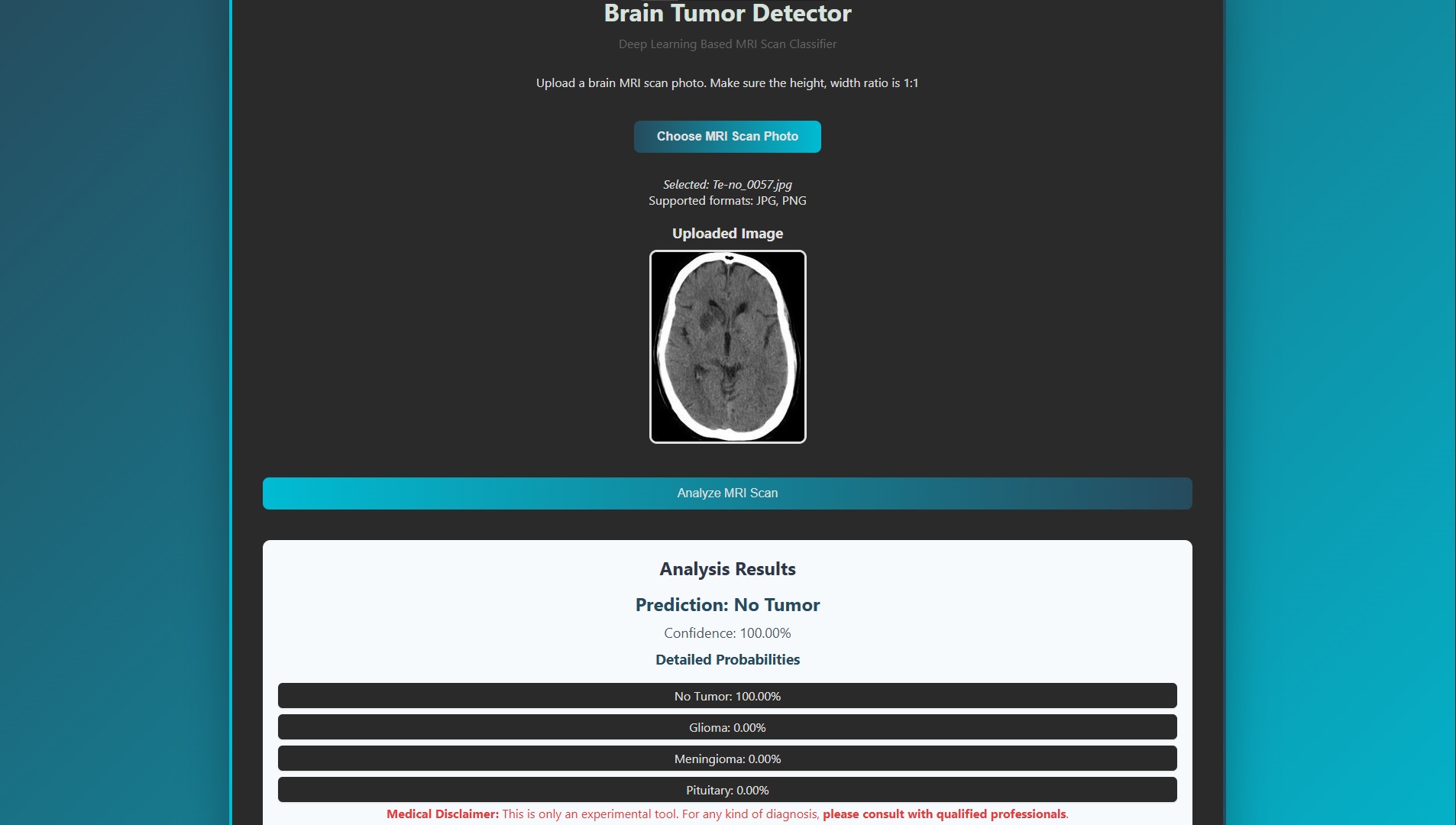 GitHub - mi-shraban/Brain_Tumor_Detector: Built a CNN model using PyTorch, and trained it with ...