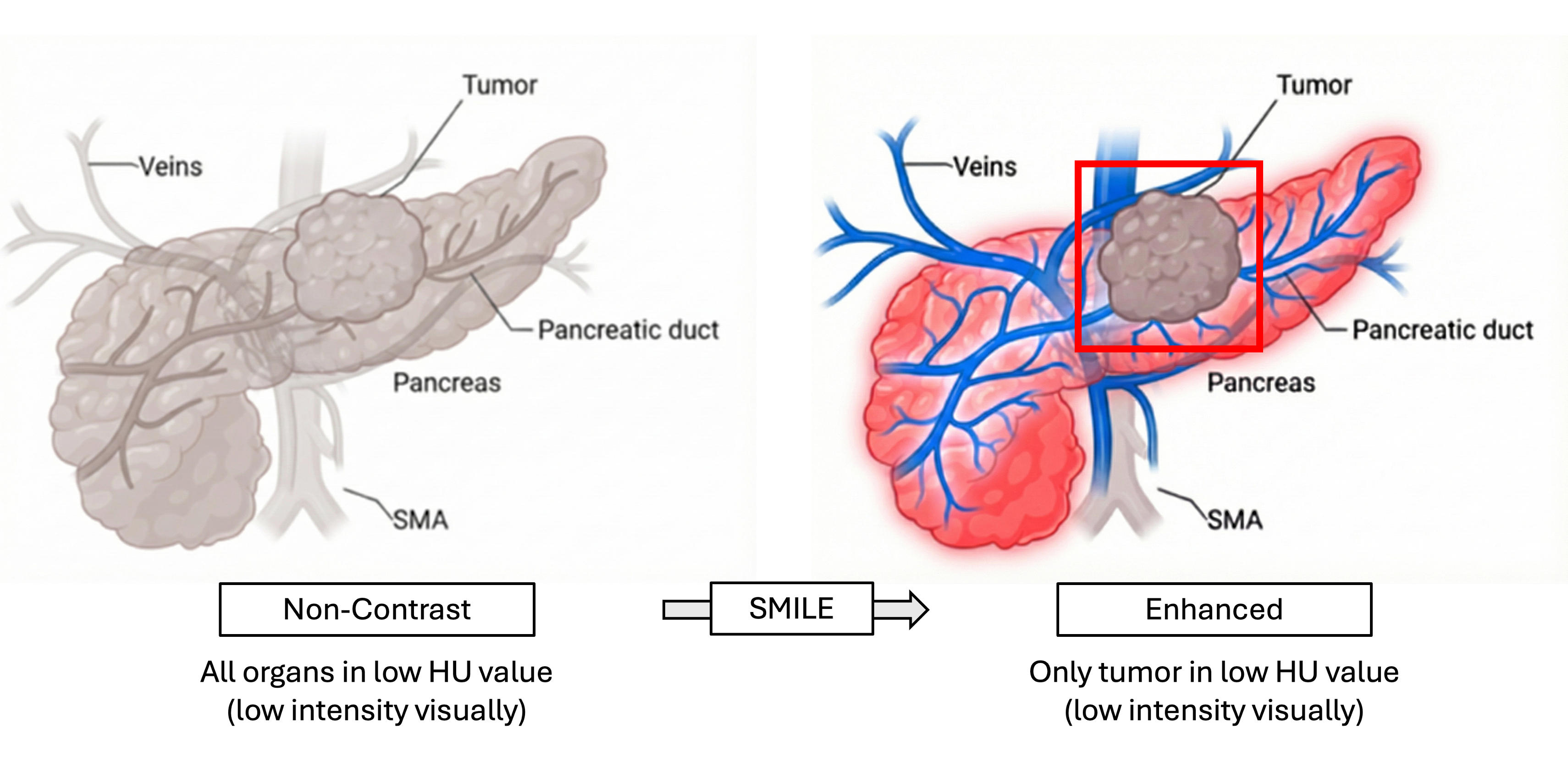 GitHub - MrGiovanni/SMILE