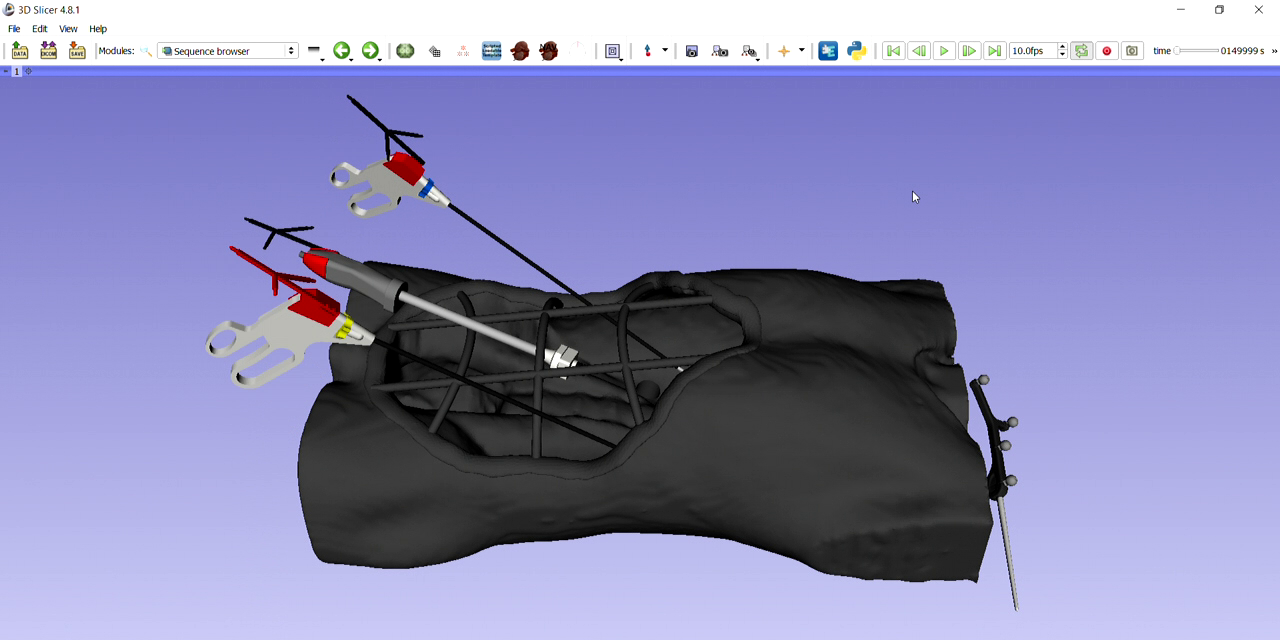 GitHub - alexispomares/3d-printed-image-guided-surgery: Developing a ...