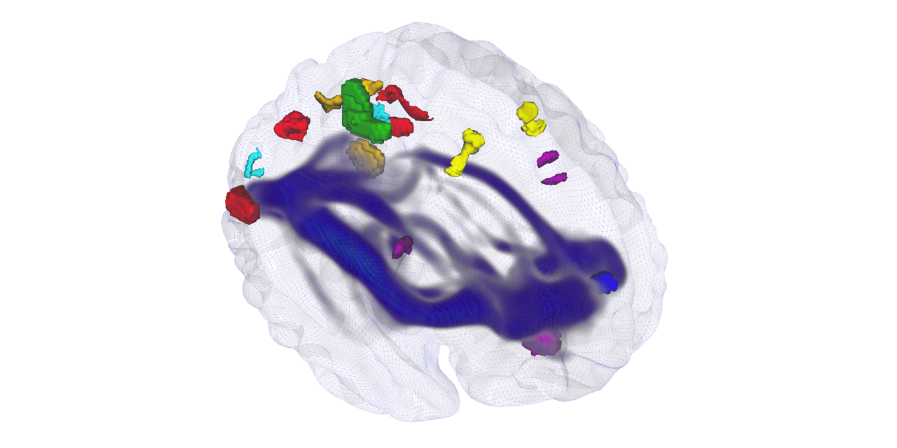 GitHub - neurocoglab/dwi-tracts: DWI probabilistic tractography-based ...