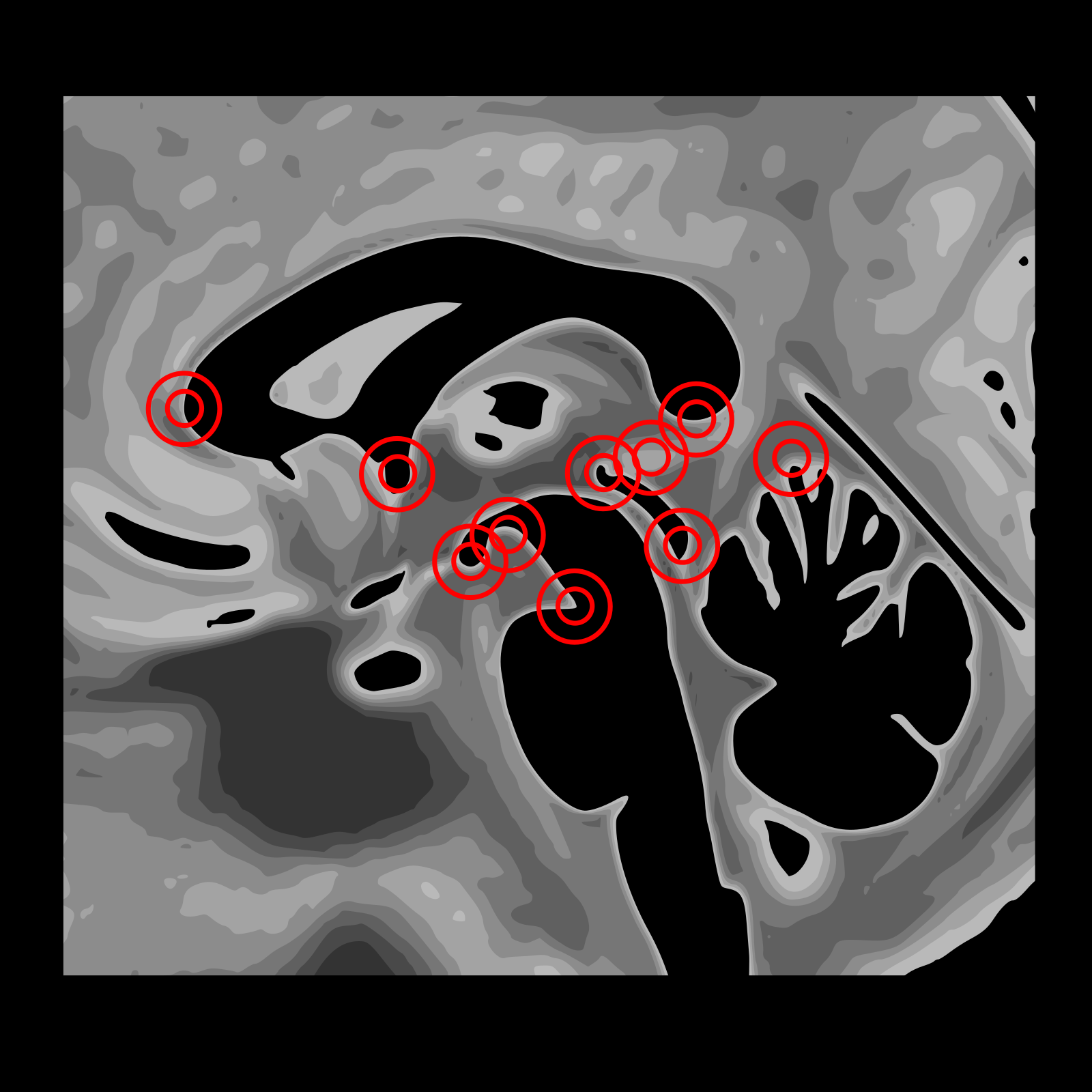 GitHub - afids/afids-examples: anatomical fiducials examples