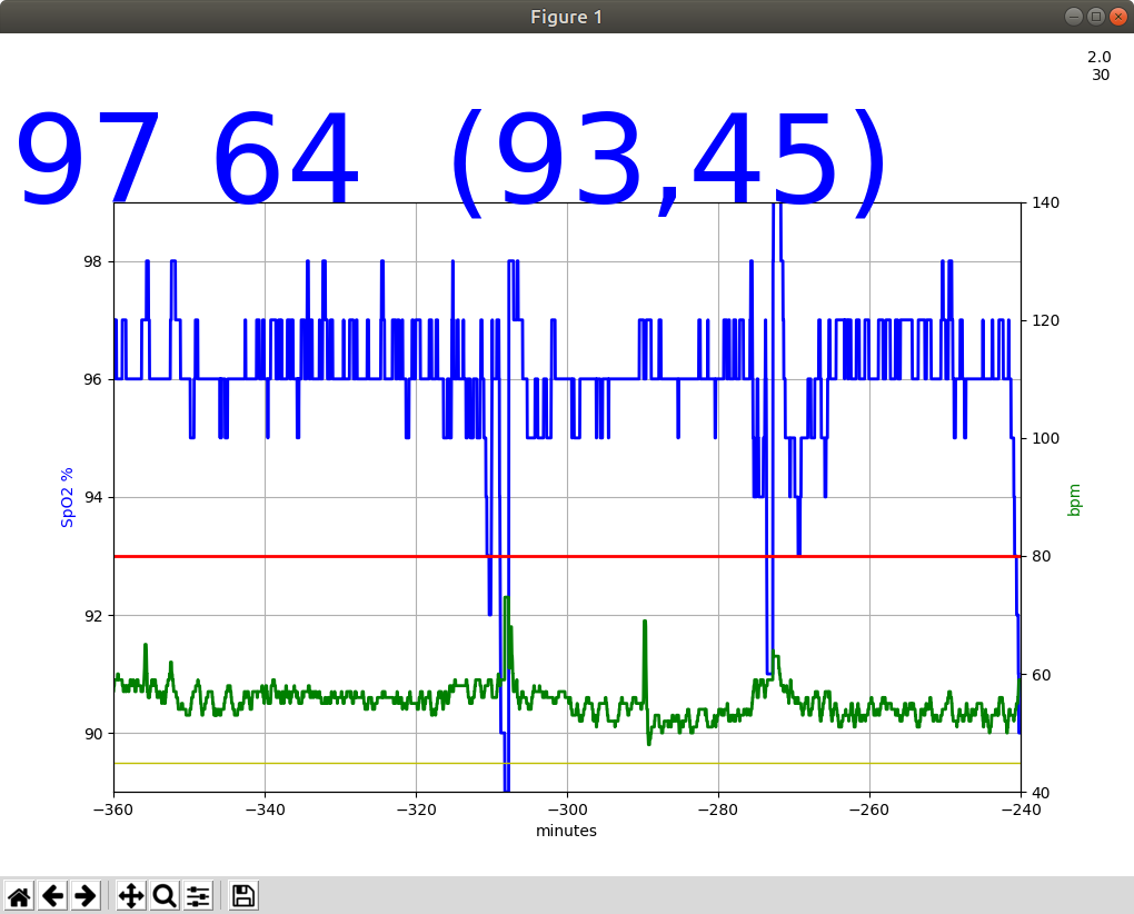 GitHub - celiponcio/oximeter-CMS50Dplus-v4.6-LIVE-data-display-store-alarm: Read live data from ...