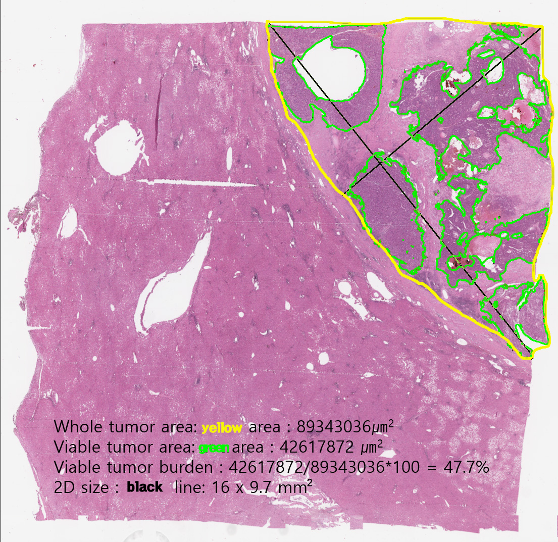 GitHub - lxc902/bmi260: final project for bmi260