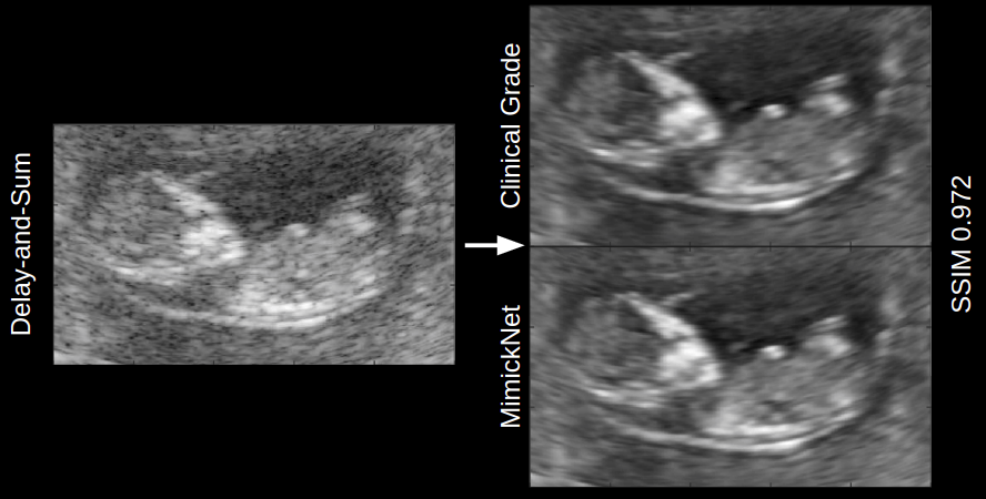 GitHub - Ouwen/MimickNet: Matching clinical-grade ultrasound post ...