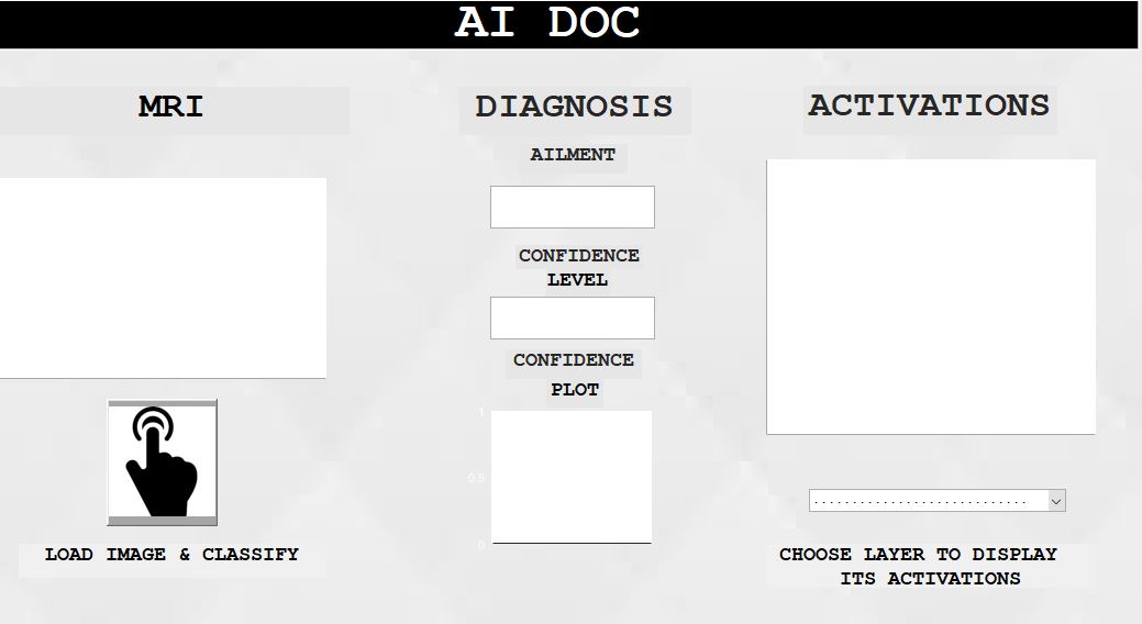 GitHub - Edwinngera/Deep-Learning-for-Brain-MRI-Classification: Deep ...