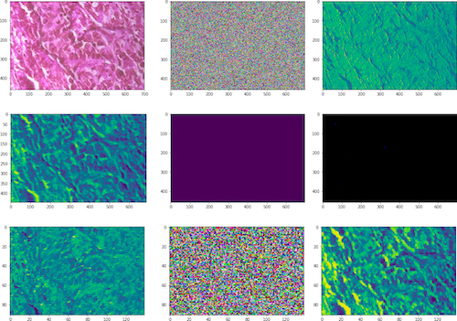 Github Aceyiyuan Tensorflow2 0 Hackathon Project âš Poweredbytf 2 0