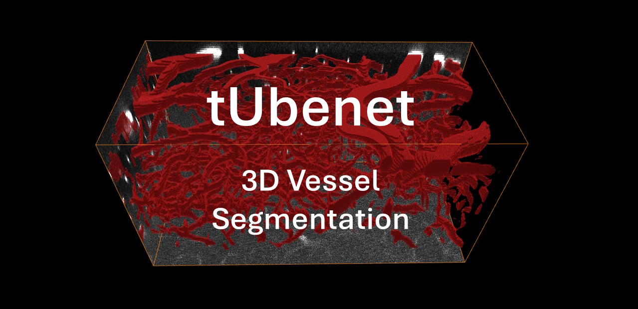 GitHub - natalie11/tUbeNet: CNN for segmenting vasculature