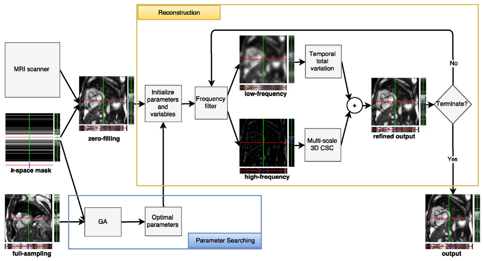 GitHub - PotatoThanh/3DCSC-for-Dynamic-MRI-Reconstruction