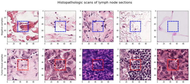 GitHub - darien-schettler/histopathologic-cancer-detection: EDA and ...