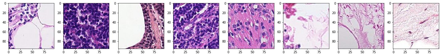 GitHub - Doc-Ix/histopathology: Based on Kaggle Challenge ...
