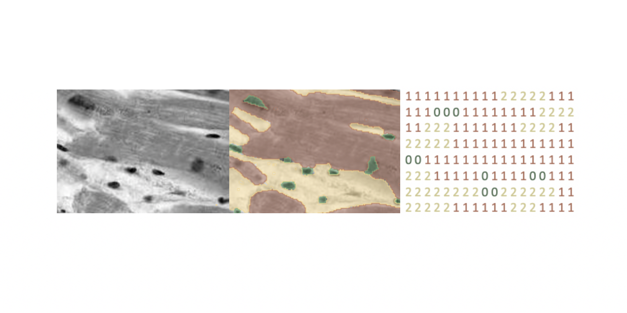 GitHub - EricaMoreira/SlicerSemSeg