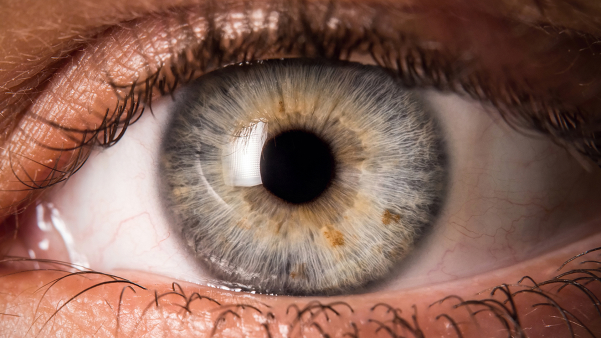 GitHub - tahsin314/40th_place_solution_aptos2019-blindness-detection ...