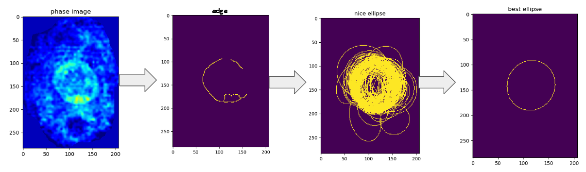 GitHub - Po-Ting-lin/RandomizedHoughEllipseDetector: find ellipse