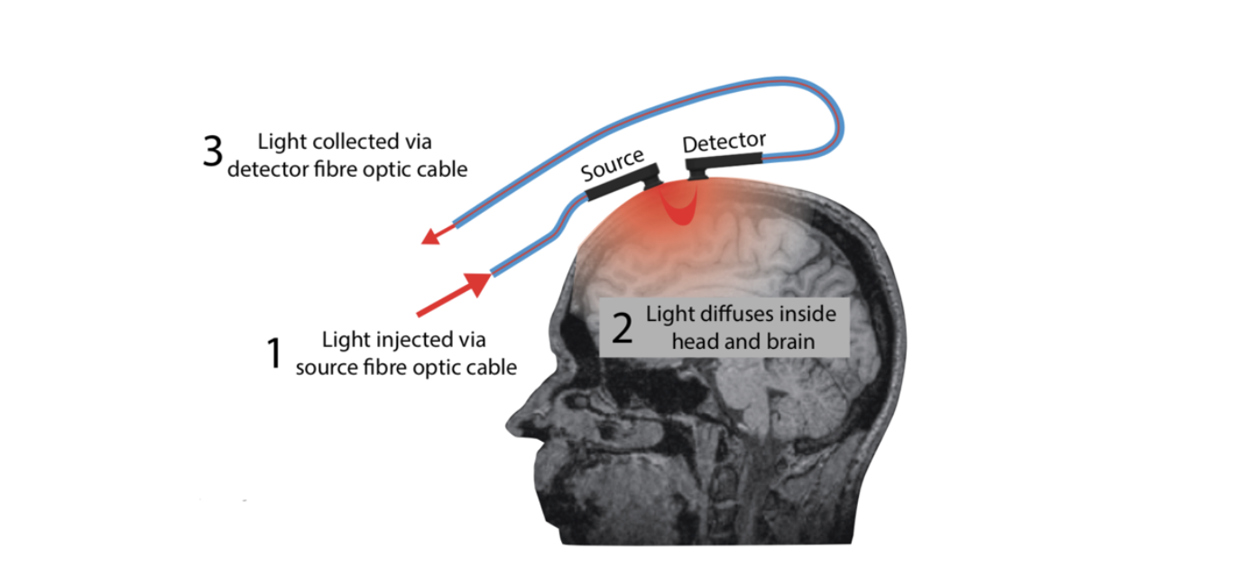 GitHub - LucyRothwell/Classifying-Stutters-Neuroscience: A research ...