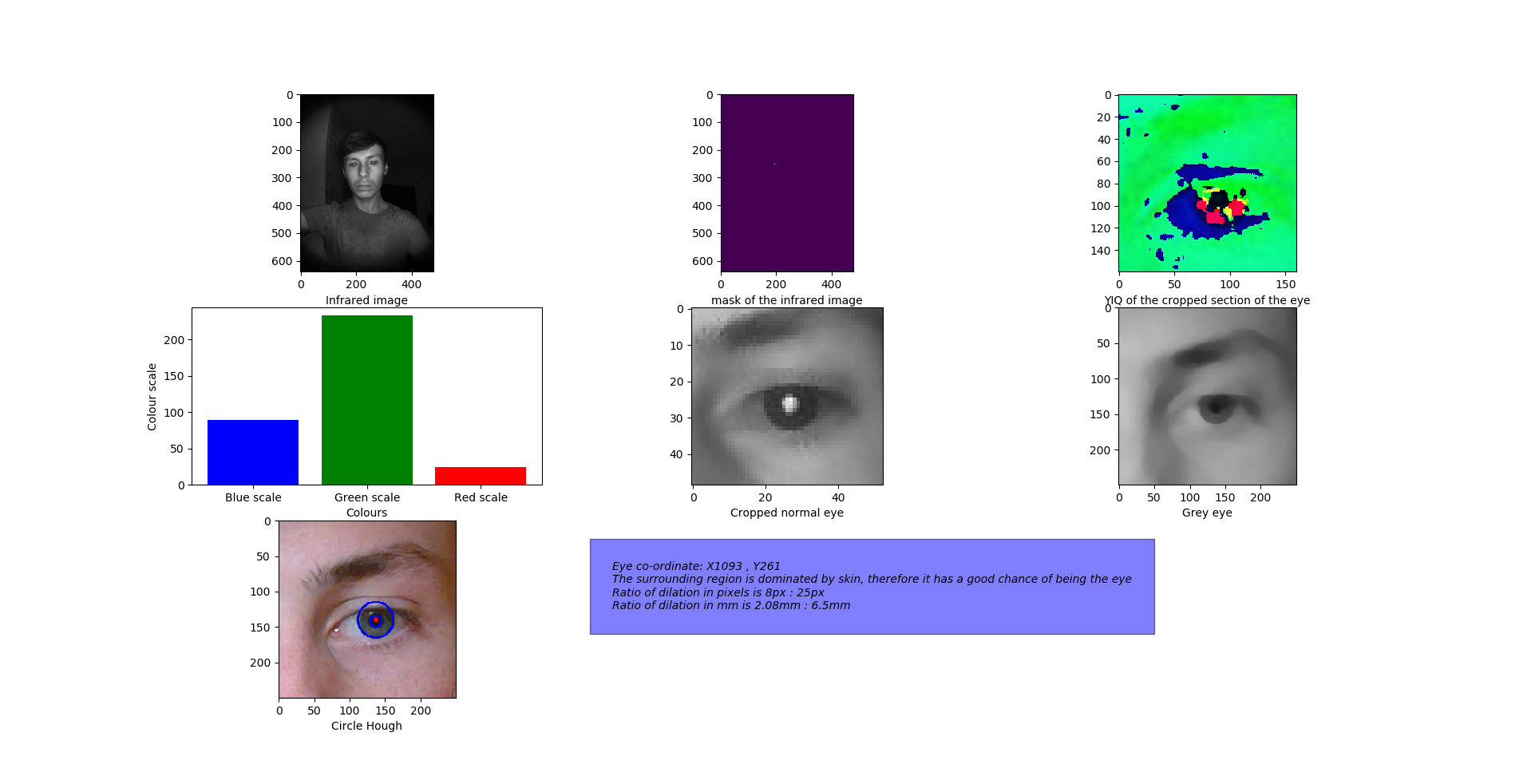 Pupil dilation measurement From KnowledgePending Coder Social