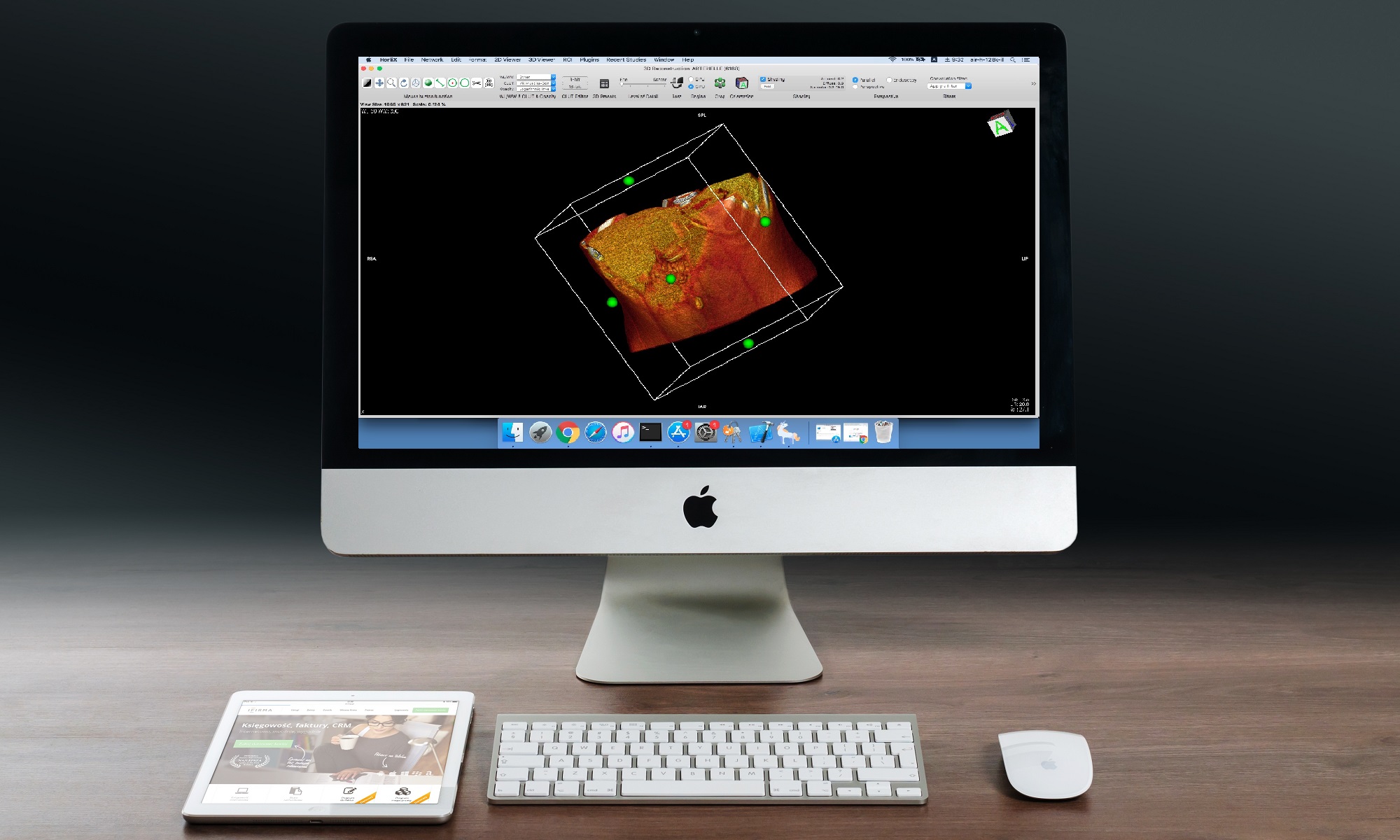 GitHub - Hiroaki-Inomata/HorliX: HorliX は Horos / OsiriX ベースの画像ビューアです