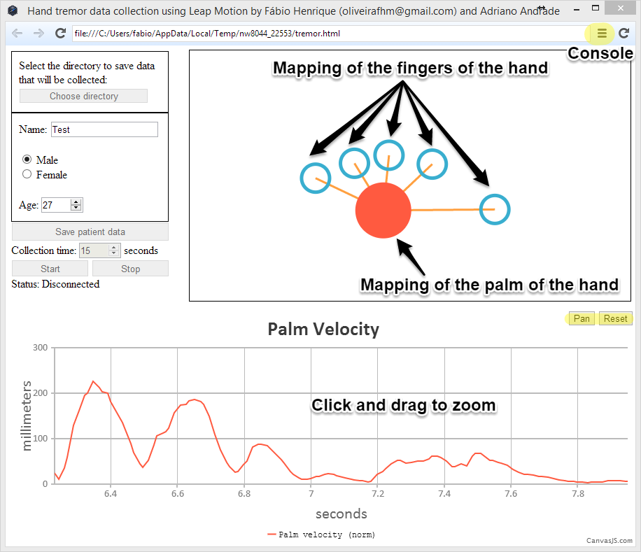 GitHub - oliveirafhm/LeapTremorDetection: LTD - LEAP TREMOR DETECTION ...