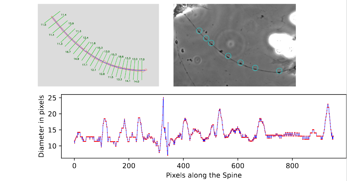GitHub - vcpKumar/Axonal-Beading-Tracker: tool for precise ...
