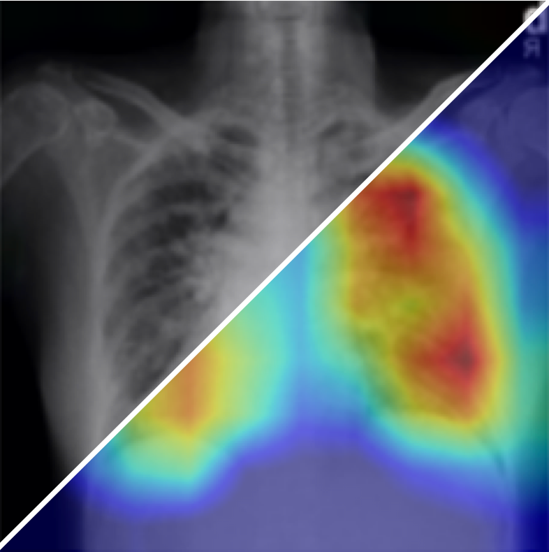 GitHub - hectorcarrion/vesta: COVID-19 detection from chest radiography