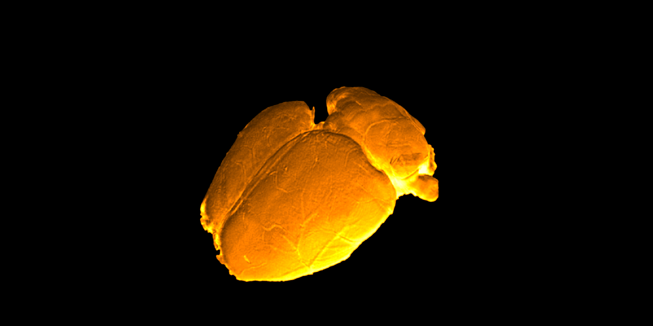 GitHub - Omnistic/OPTReconstruction: Optical projection tomography (OPT ...
