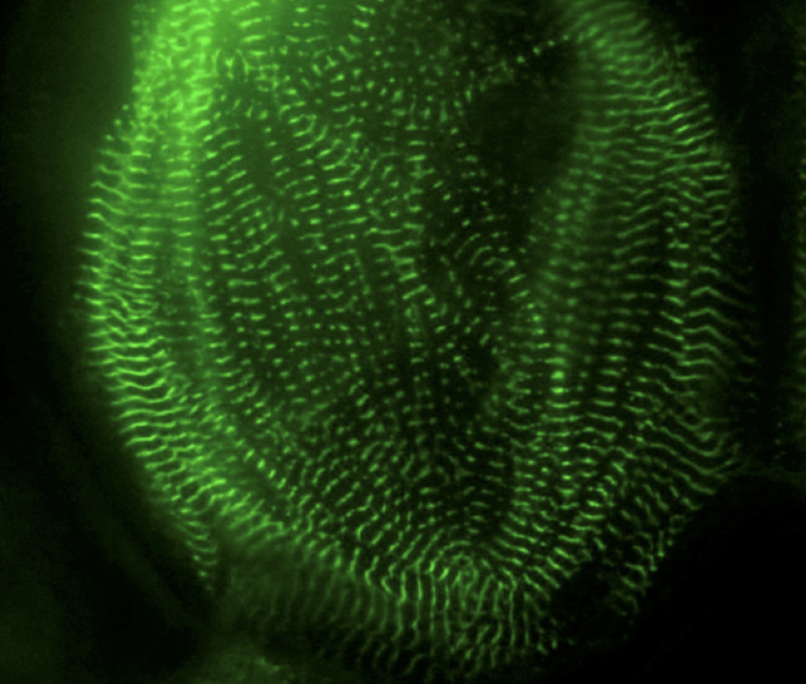 GitHub - ToepferLab/SarcTrack: Fluorescent sarcomere tracking algorithm. As per https://www ...