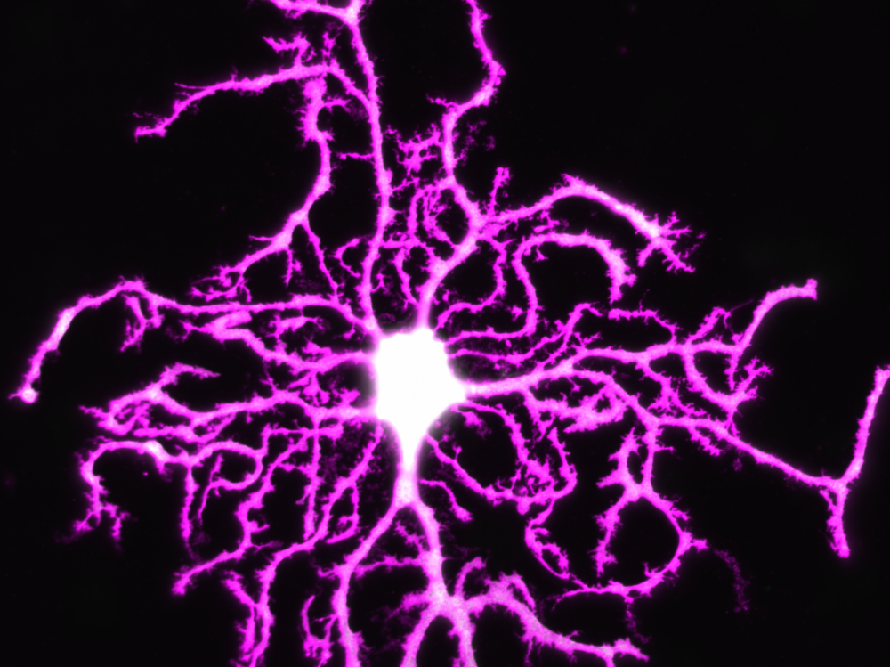 GitHub - Eroglu-Lab/In-Vitro-Sholl