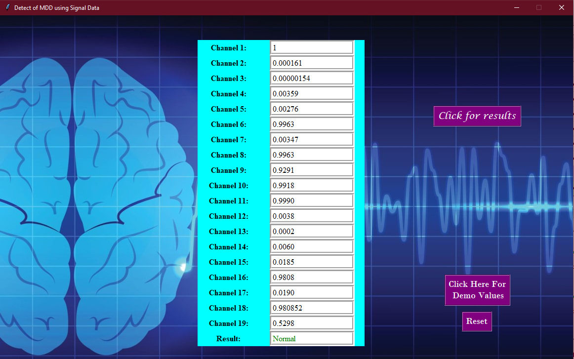 GitHub - axelblaze11/Expert-System-On-Major-Depressive-Disorder-using-Python: Expert System on ...