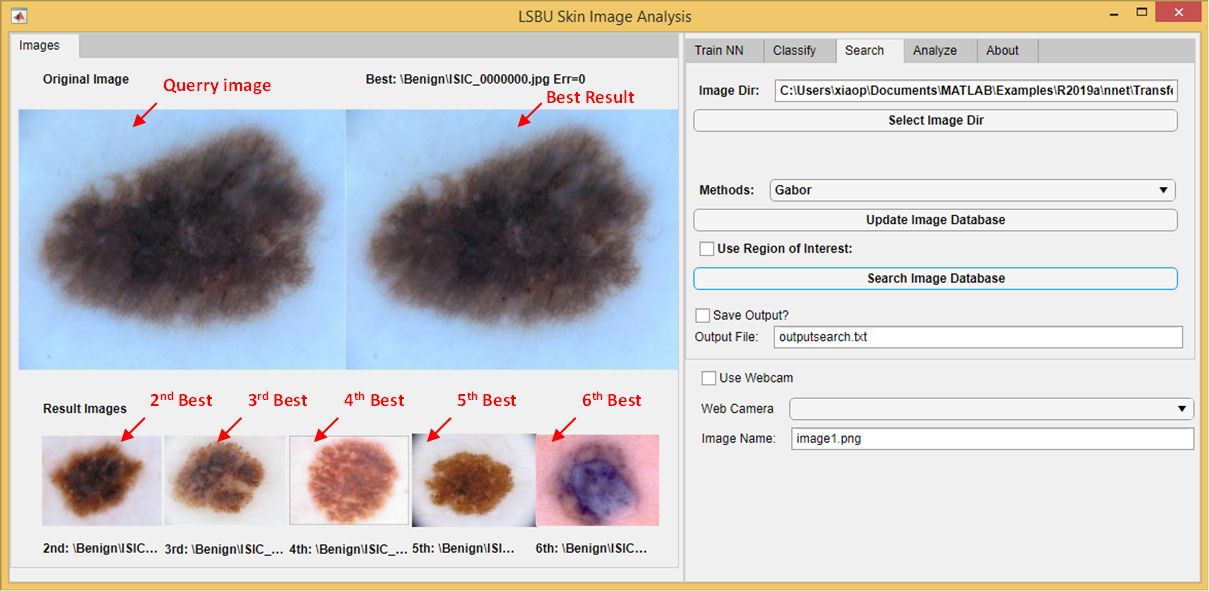 Github Perryxiao2015lsbu Skin Image Analysis Tool This Graphical User Interface Gui Based