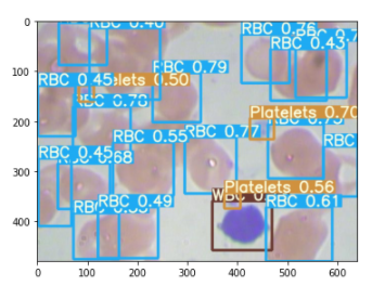 GitHub - bala-codes/Yolo-V5_Object_Detection_Blood_Cell_Count_and ...
