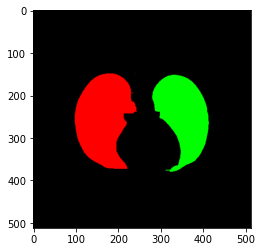 GitHub - DemyCode/lungs_tumor_segmentation