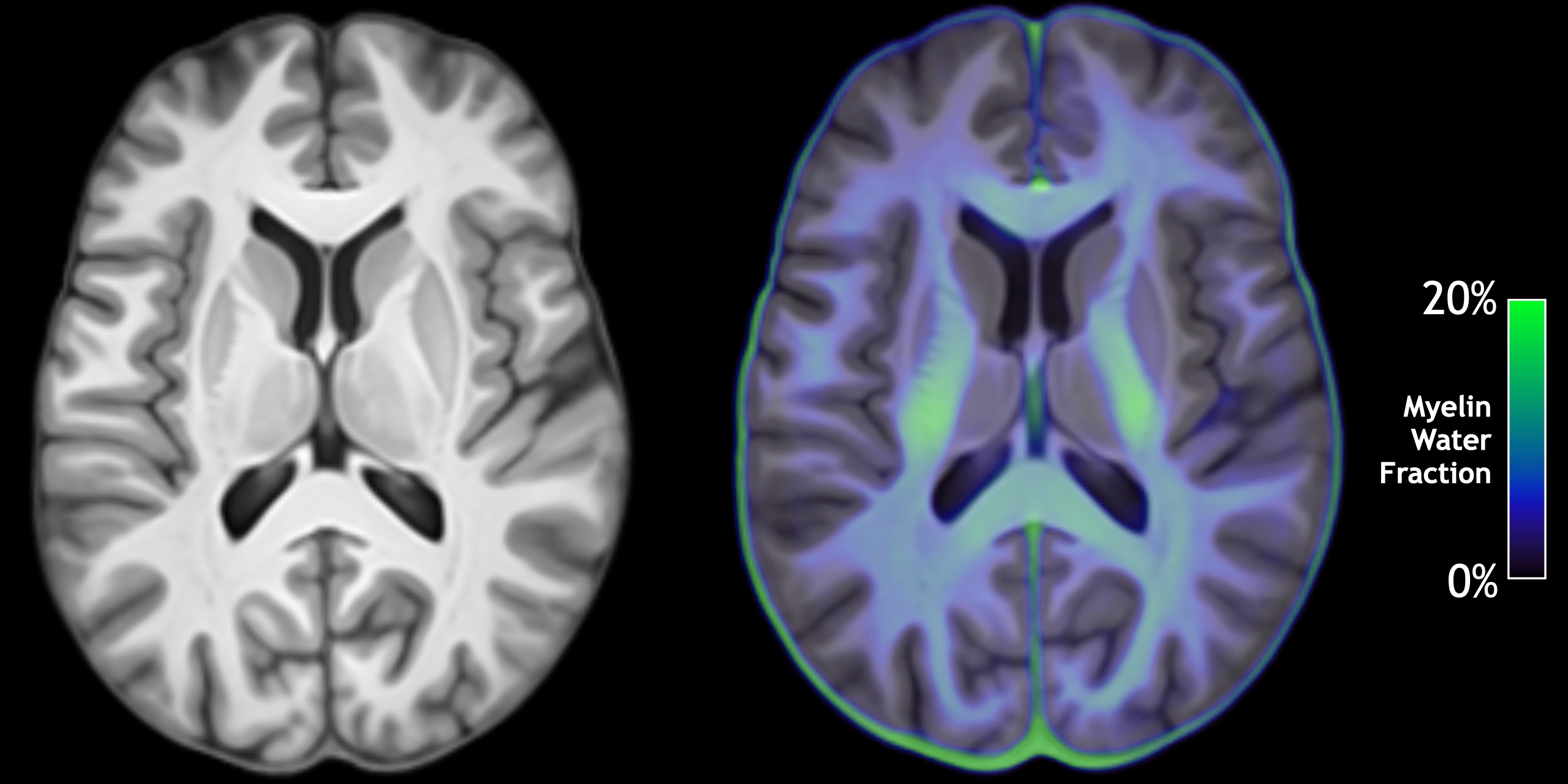 GitHub - avdvorak/myelin-atlas: Example code: An atlas for human brain myelin content throughout ...