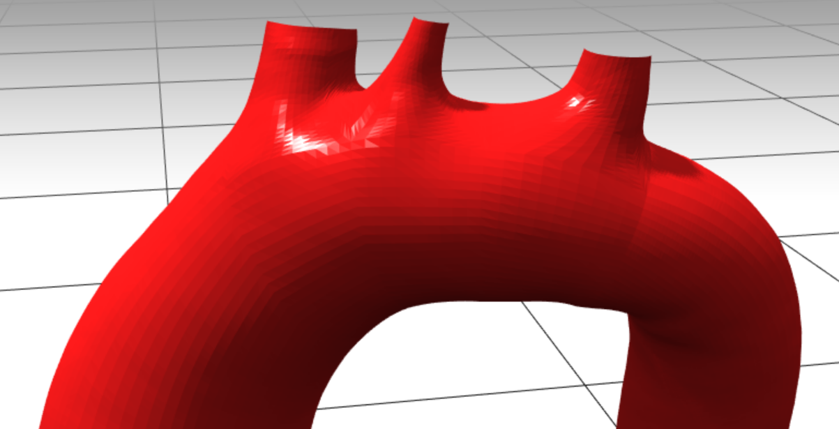 GitHub - tmaquart/WEB_APP_SSA_ATAA: Statistical Shape Analysis (SSA ...