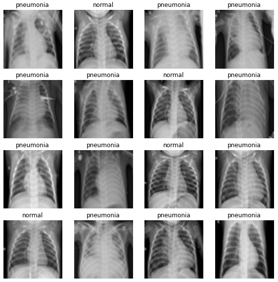 GitHub - mariostrbac/pneumonia-detection-in-chest-xrays: Pneumonia ...