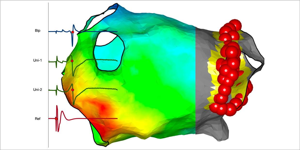 GitHub - openep/openep-core: Core OpenEP code - Matlab implementation