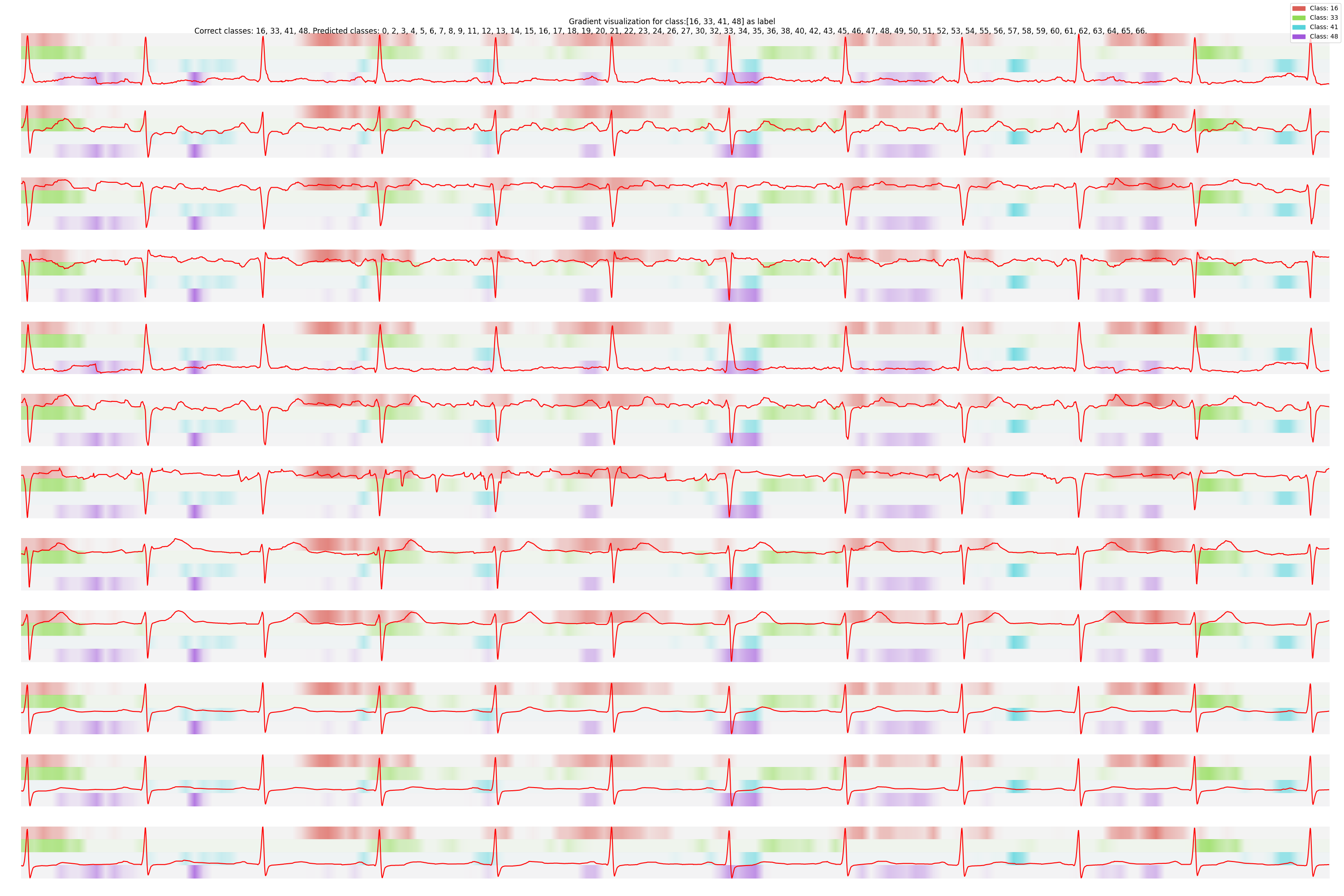 GitHub - JulianWinter1124/ecg-cpc: Masterarbeits Code