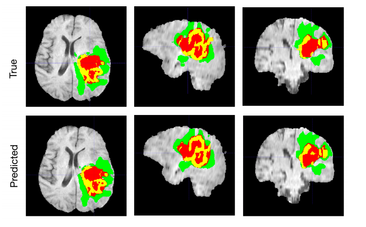 GitHub - lukeclarke12/Brain-Tumor-Image-Classification-Project: This is ...