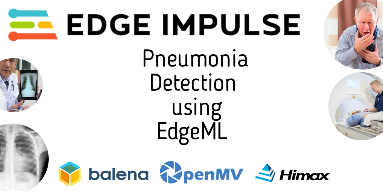 GitHub - arijitdas123student/pneumonia-detection-edgeml: Pneumonia ...