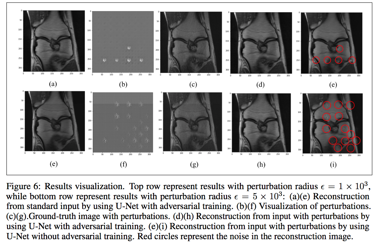 GitHub - Buyun-Liang/Robustness-of-Deep-Learning-in-MRI-Reconstruction