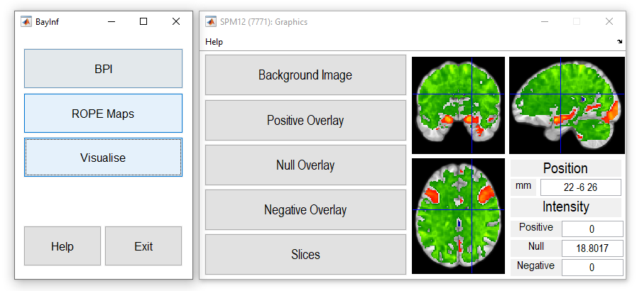 GitHub - Masharipov/Bayesian_inference: BayInf toolbox for group-level fMRI analysis (based on ...