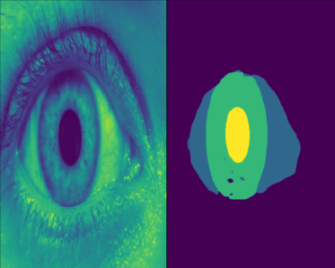 GitHub - AsWali/eye-segmentation