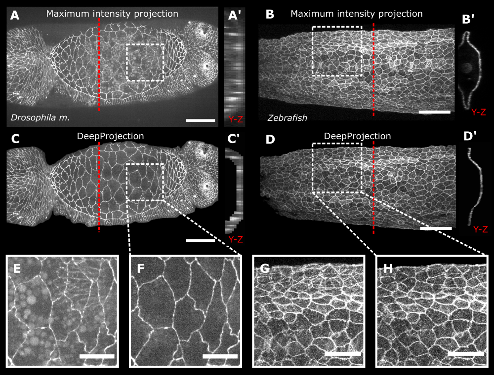 GitHub - danihae/DeepProjection: Trainable 2D projection of 3D ...
