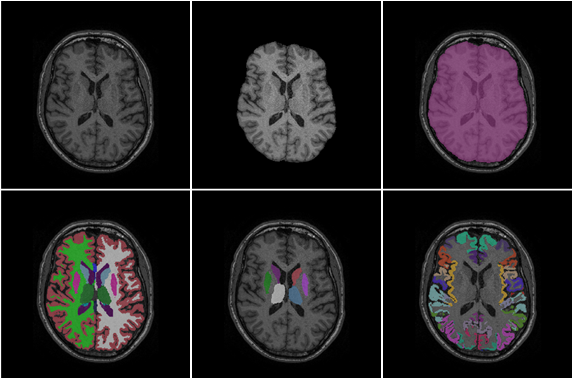 GitHub - htylab/tigerbx: Deep-learning framework for MRI segmentation