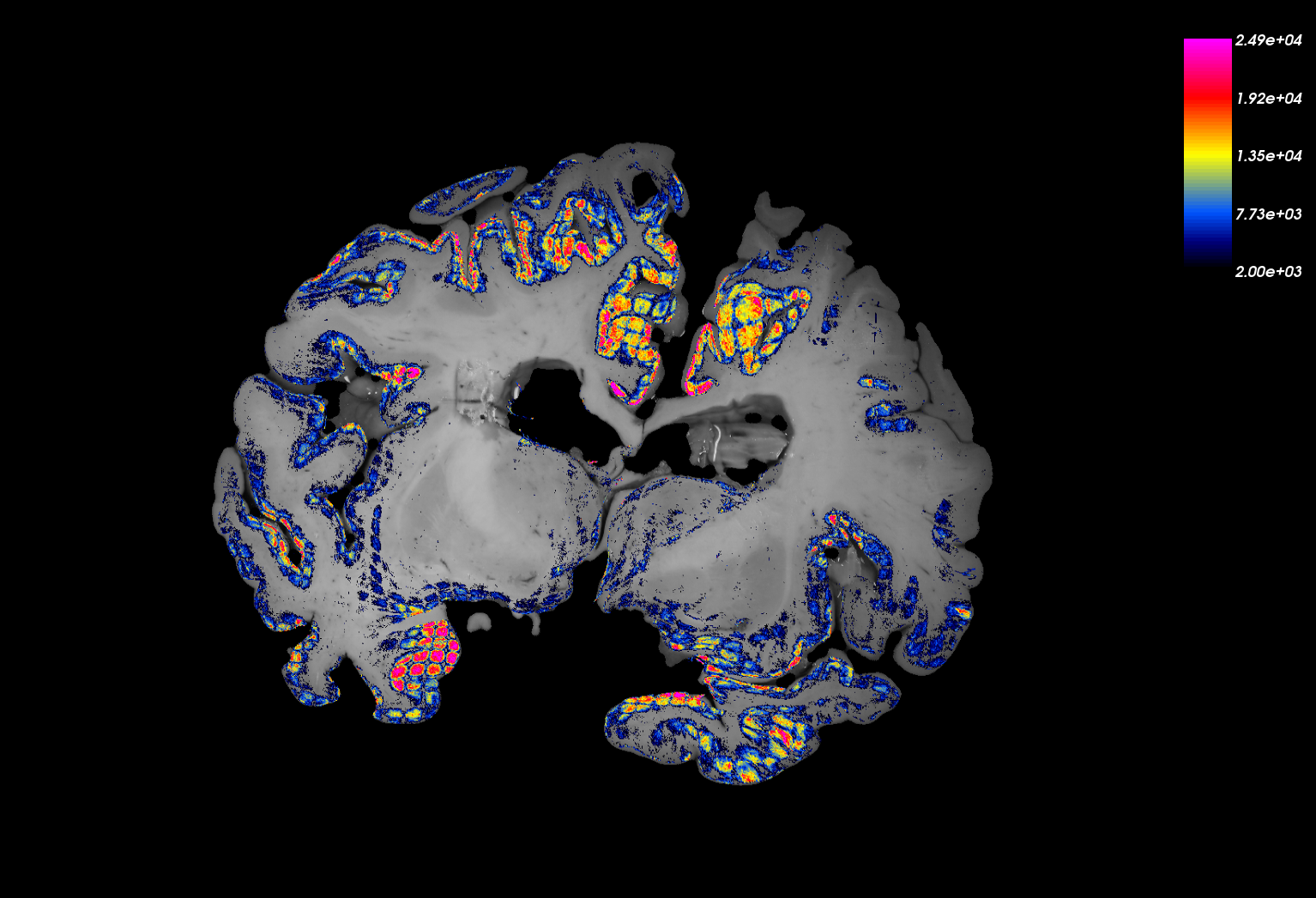 GitHub - grinberglab/high-res-3D-tau: codes for projects using deep learning to segment tau and ...