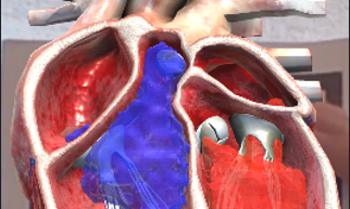 GitHub - Zai-shen/CARdiFlow: AR Cardiac Blood Flow Simulation for ...