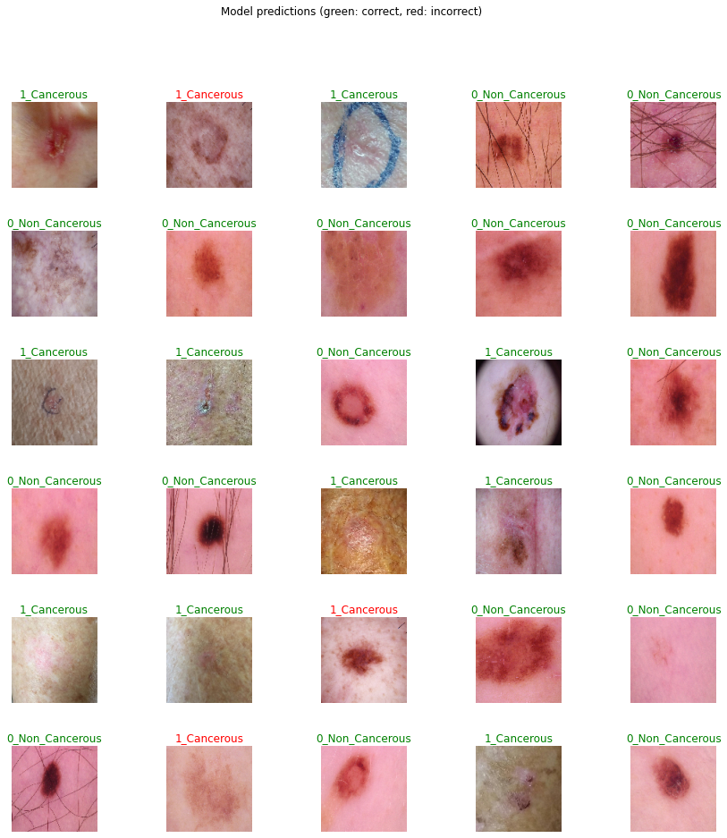 GitHub - NataliaKra/Skin_lesions_classifier: This the repo for the final project of LHL Data ...