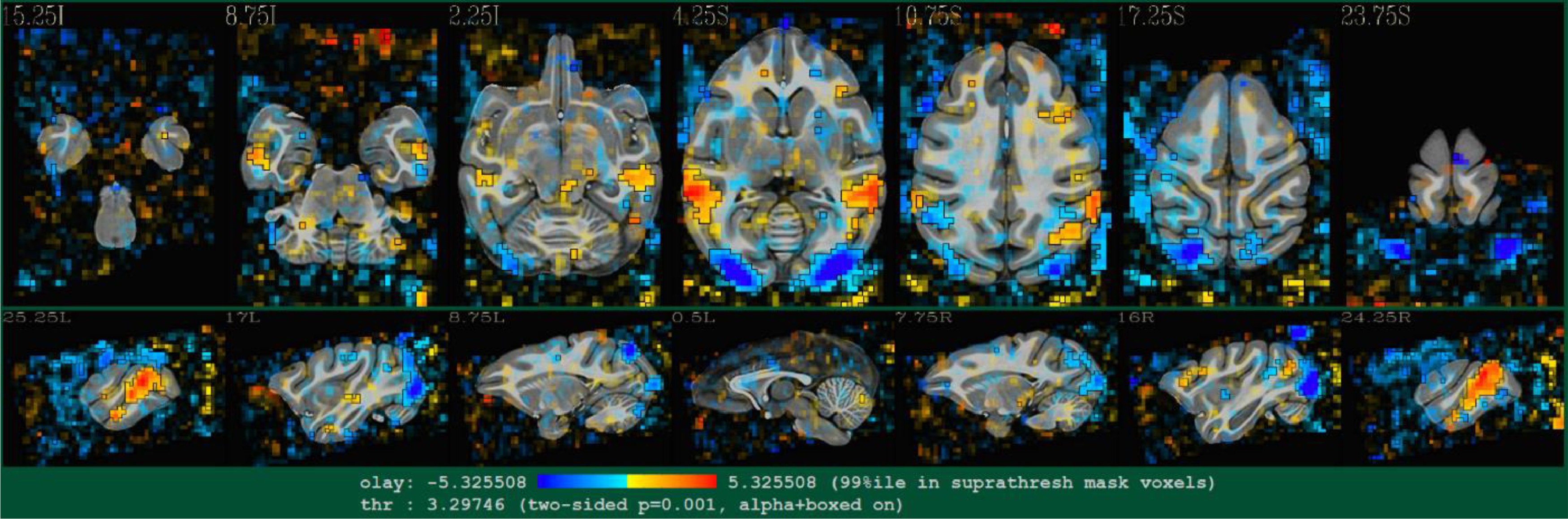 Github Afni Ademo Macaque Demo Scripts And Text Files Used In