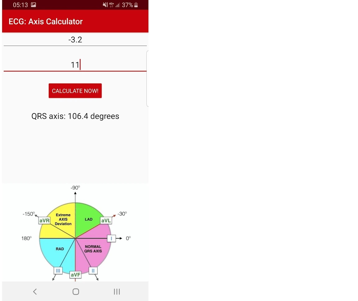 GitHub - Hagai-Ha/Android-app---ECG-QRS-Calculator