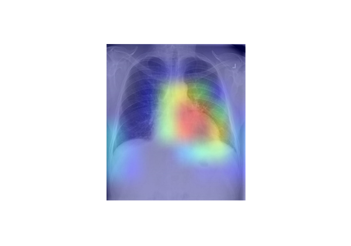 GitHub - Mithul-Joseph/Pathology-Detection