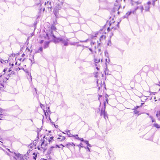 GitHub - AquaSpare/DL-segmentation-calssification: Deep learning based ...